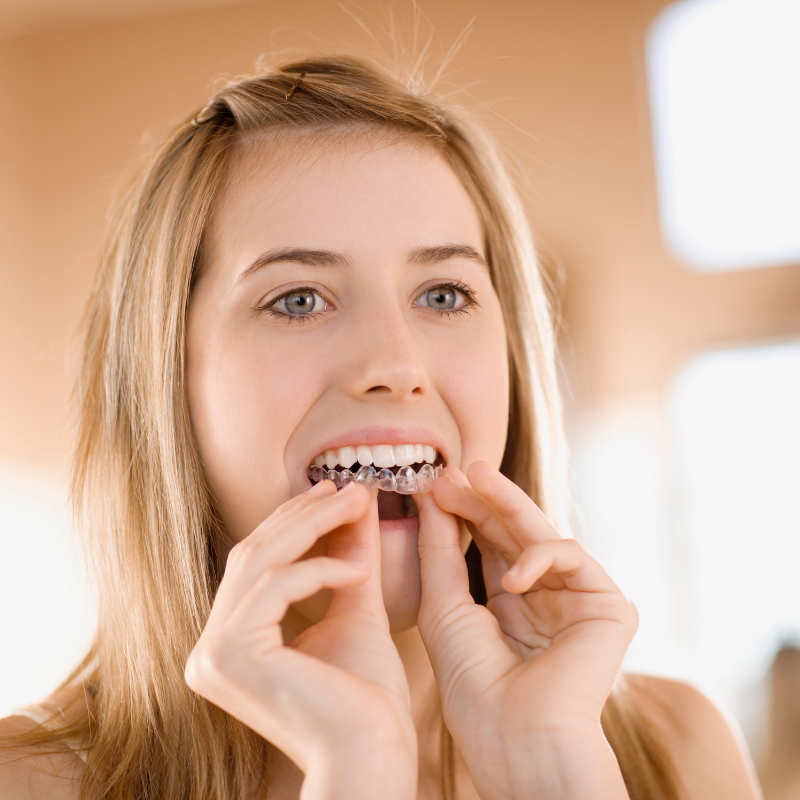 Invisalign vs. Braces - Hunsaker Dental - Aumsville, Monmouth & Salem
